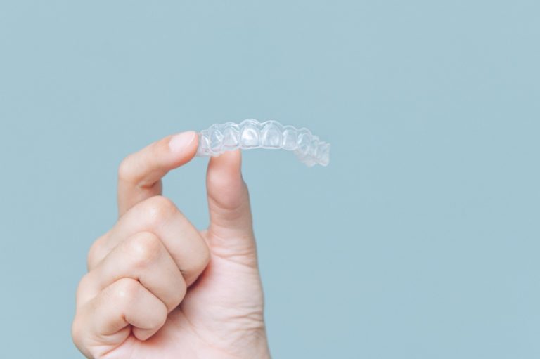 Invisalign Step-by-step Process Edison | Signature Smiles